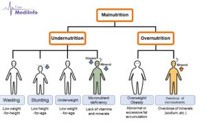 Types Of Malnutrition - FreeMedi Info